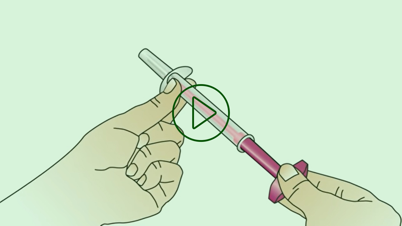 Sheba HPV Test – Yemaachi